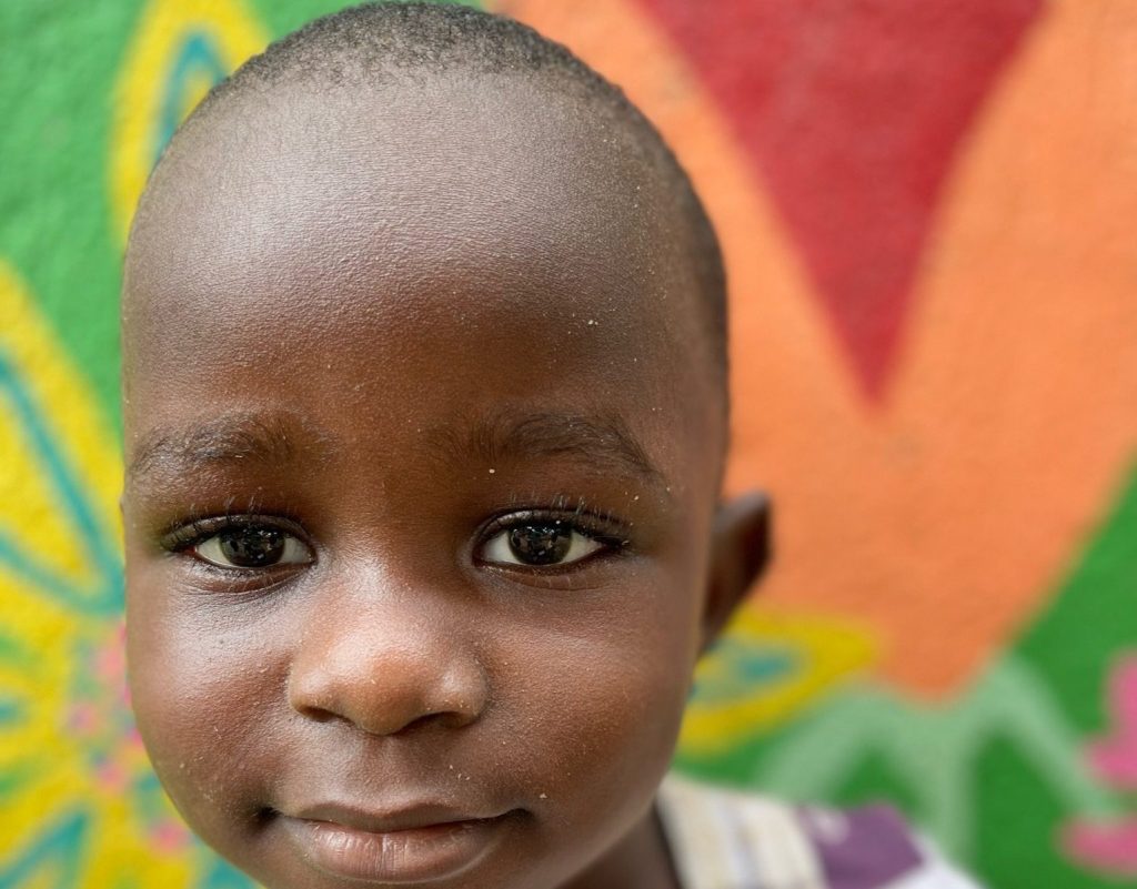 Sickle Cell Disease – Know Your Genotype